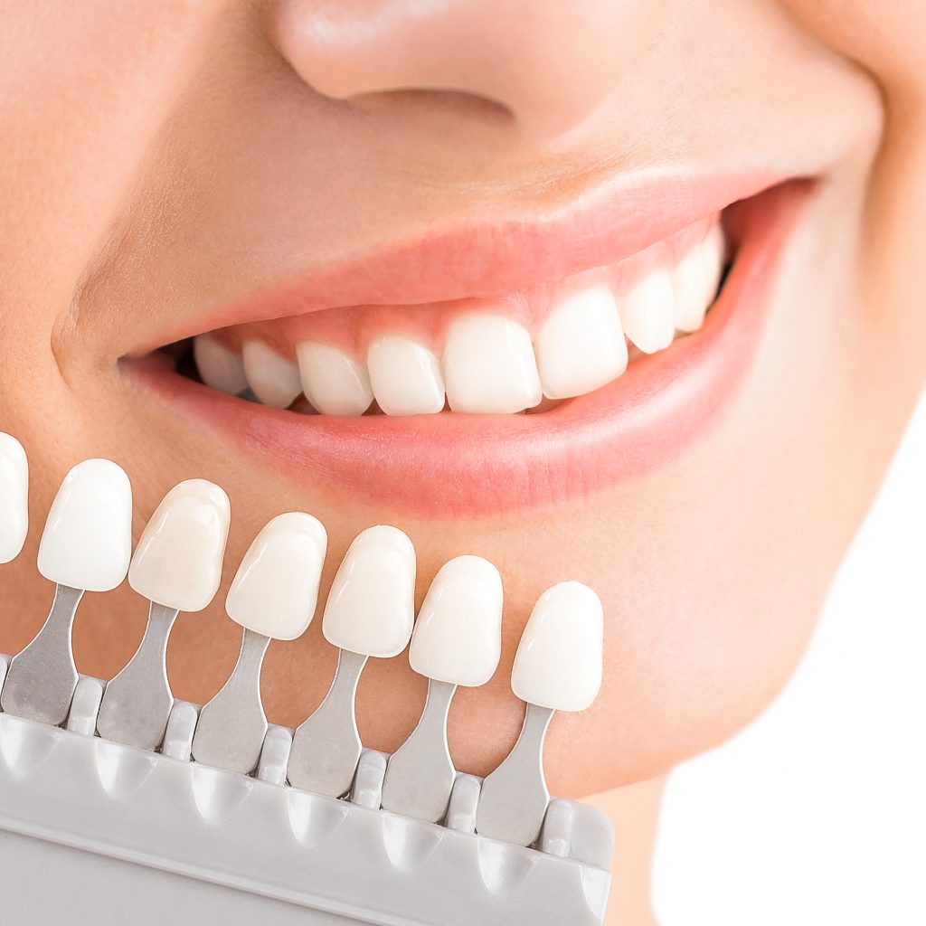 Cosmetic Fillings: Enhance Your Smile with Tooth-Coloured Fillings ...